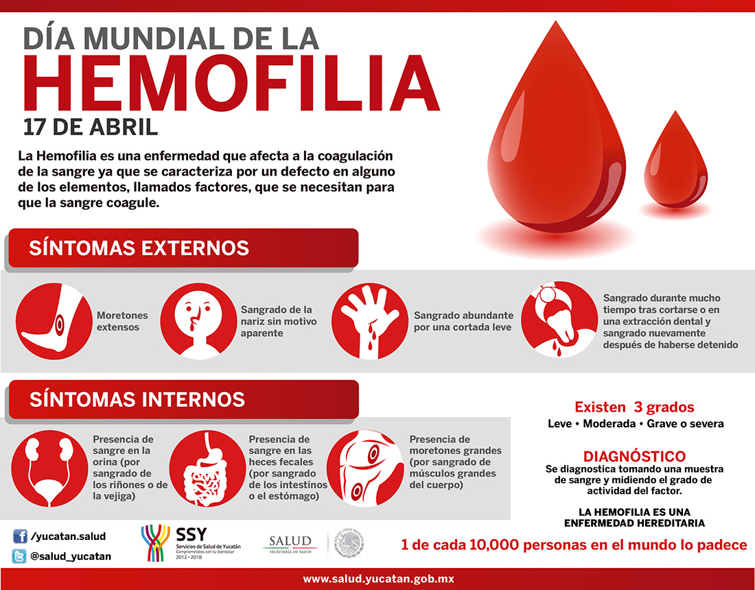 Hemofilia, un trastorno sanguíneo que afecta aproximadamente 2.000 ...